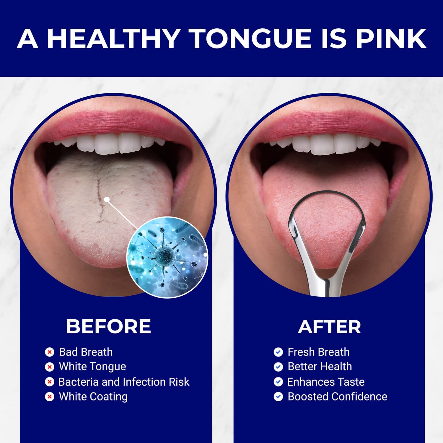 Tongue Scraper | Oravix